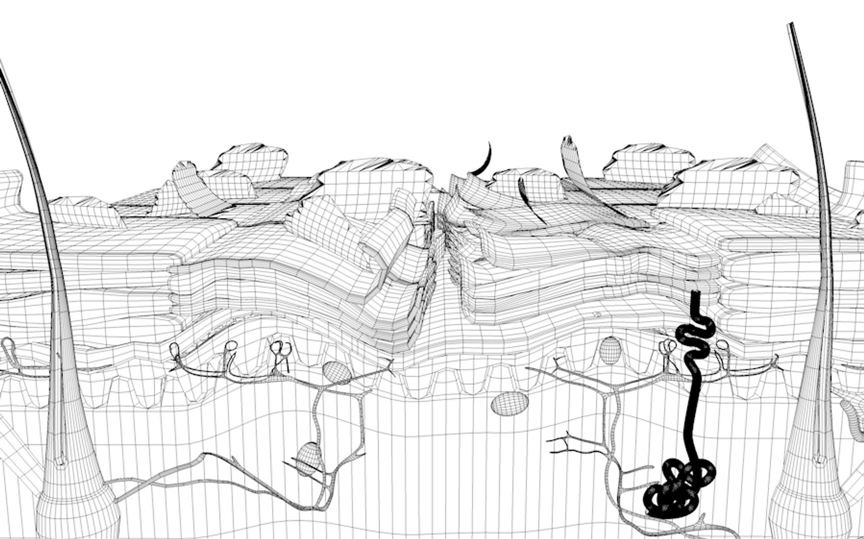 3d model of skin damage