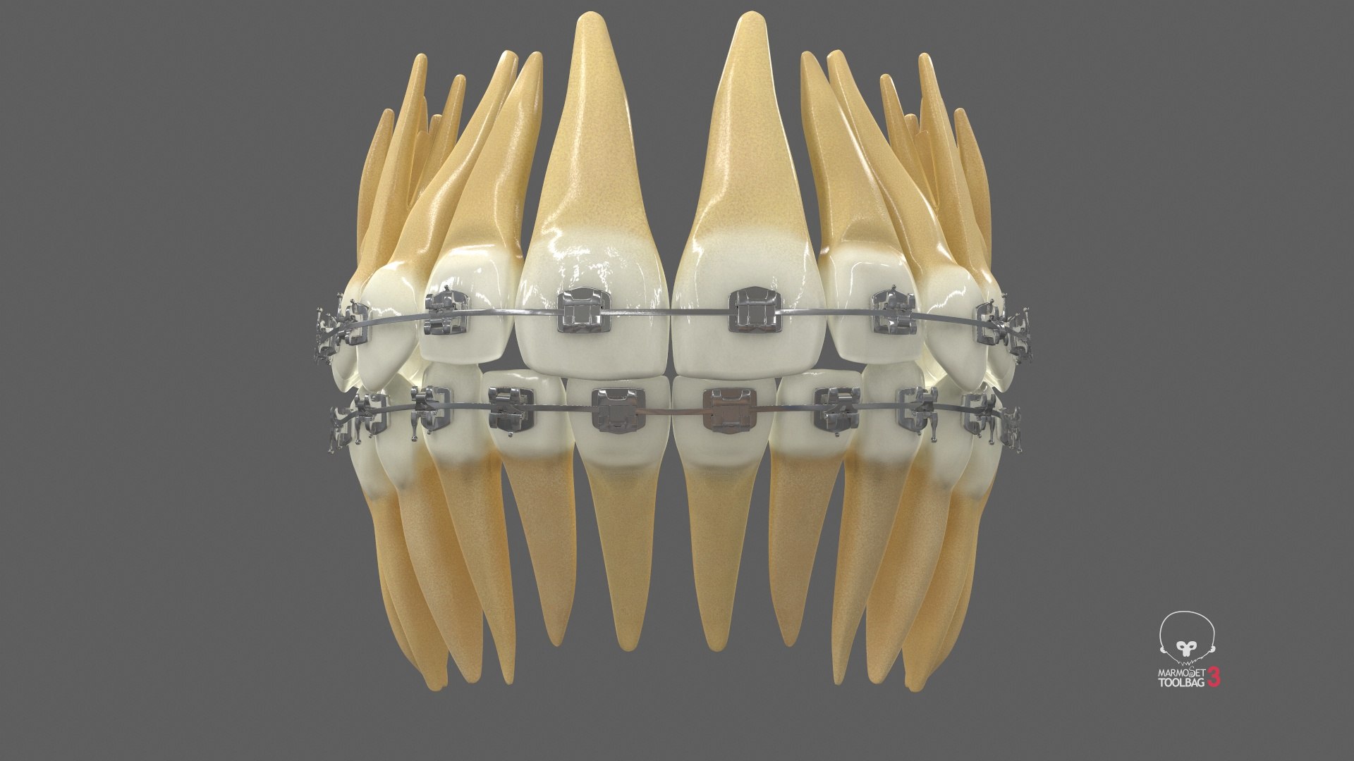 3D Human Teeth With Self Ligating Steel Dental Braces V03 - TurboSquid ...