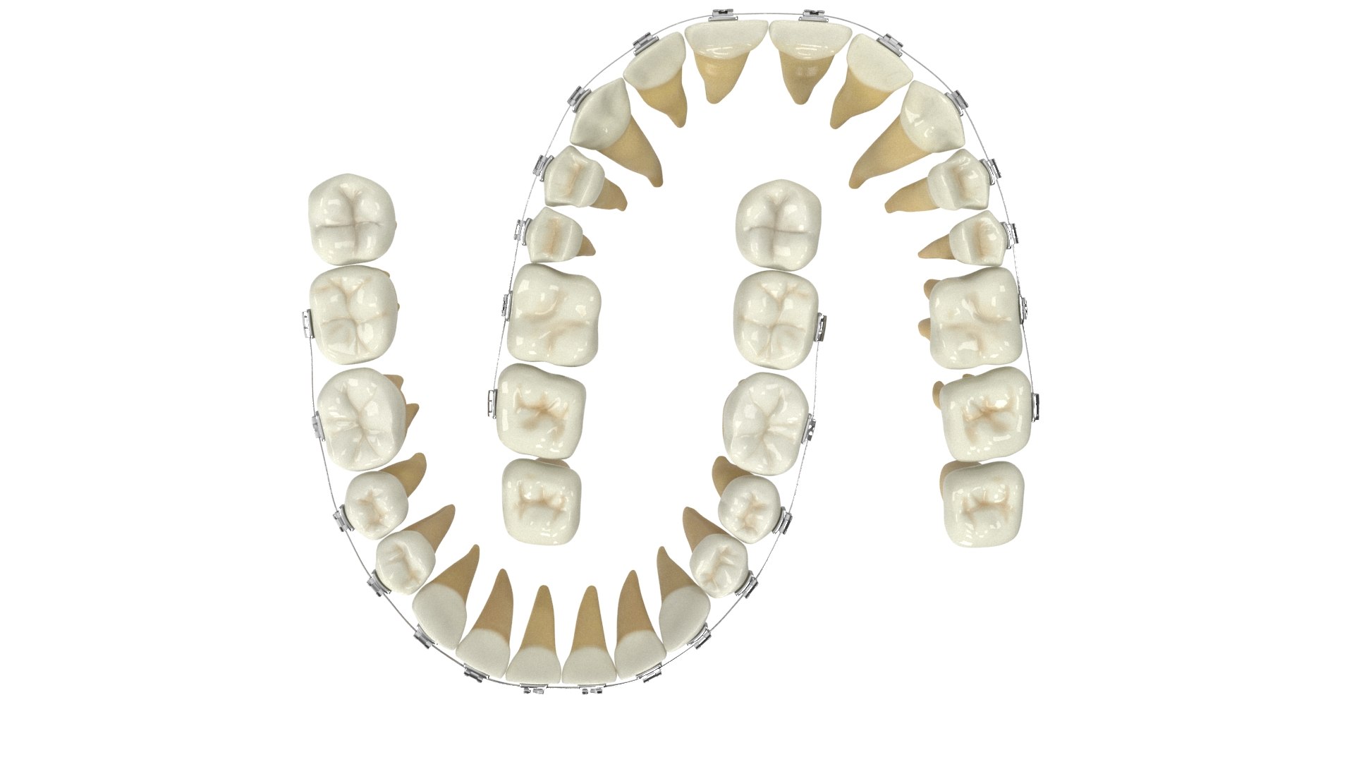 3D Human Teeth With Self Ligating Steel Dental Braces V03 - TurboSquid ...