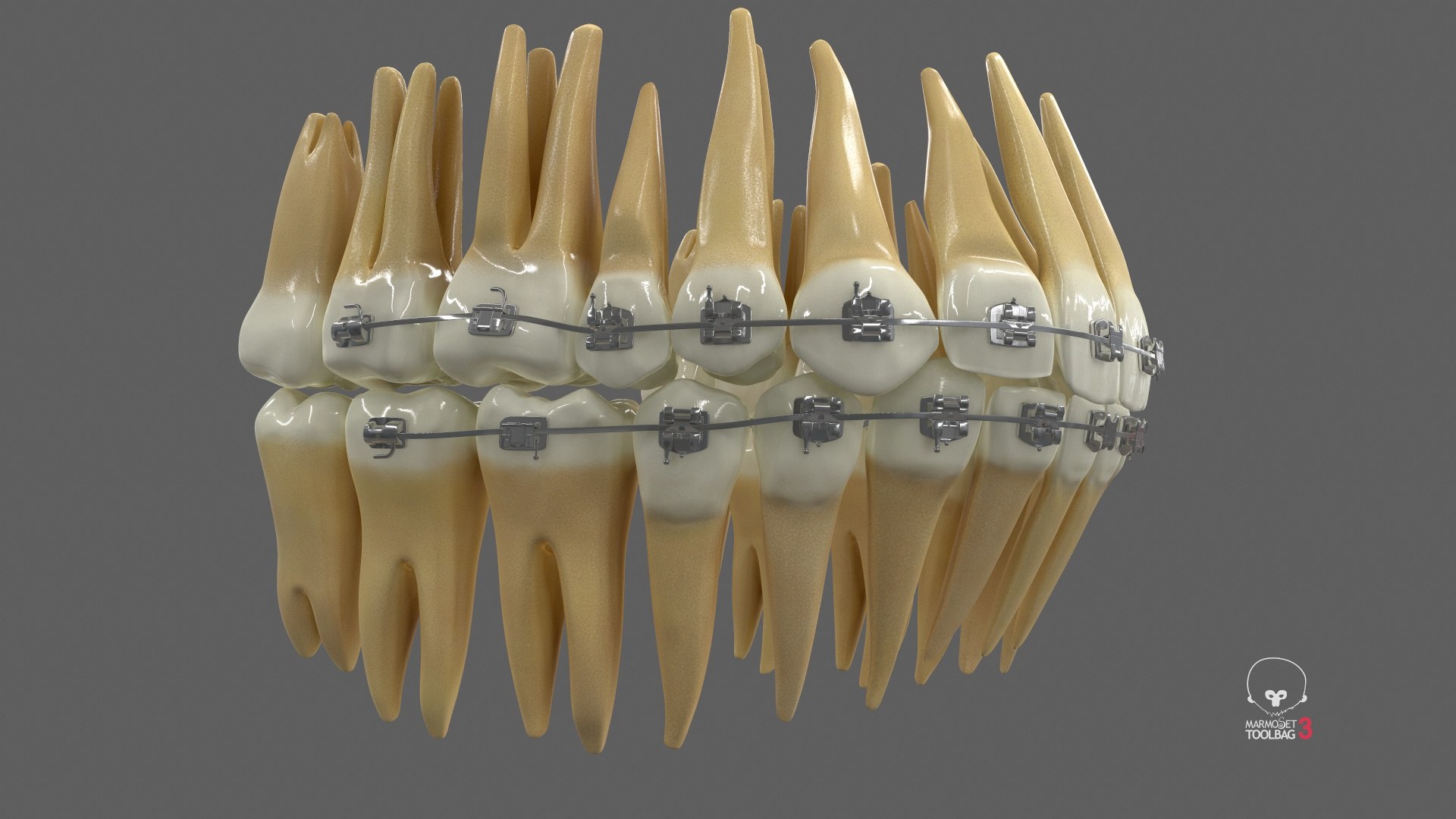 3D Human Teeth With Self Ligating Steel Dental Braces V03 - TurboSquid ...