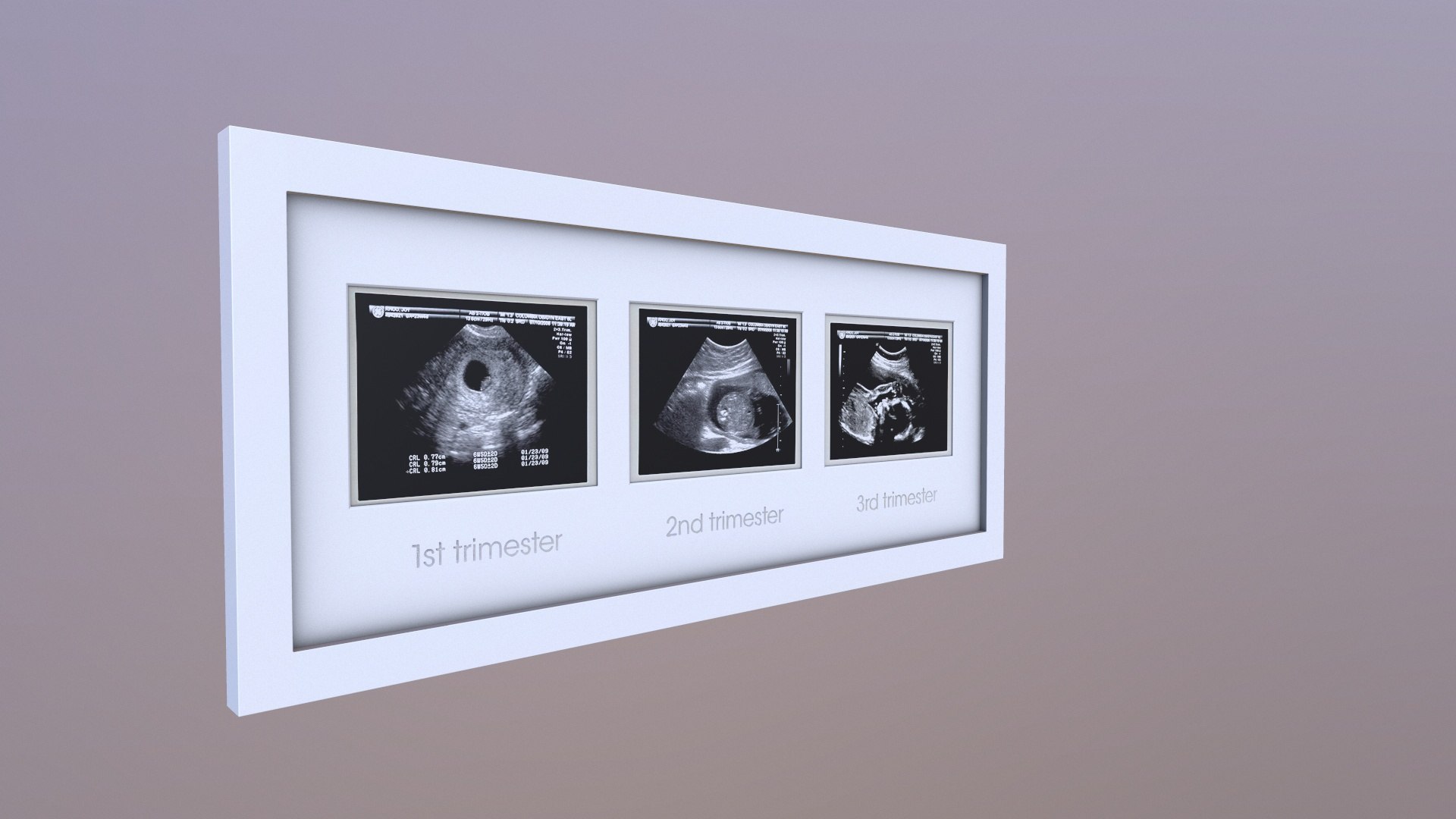 3D Pregnancy Frame Baby Scan Photo Frame - TurboSquid 2152083