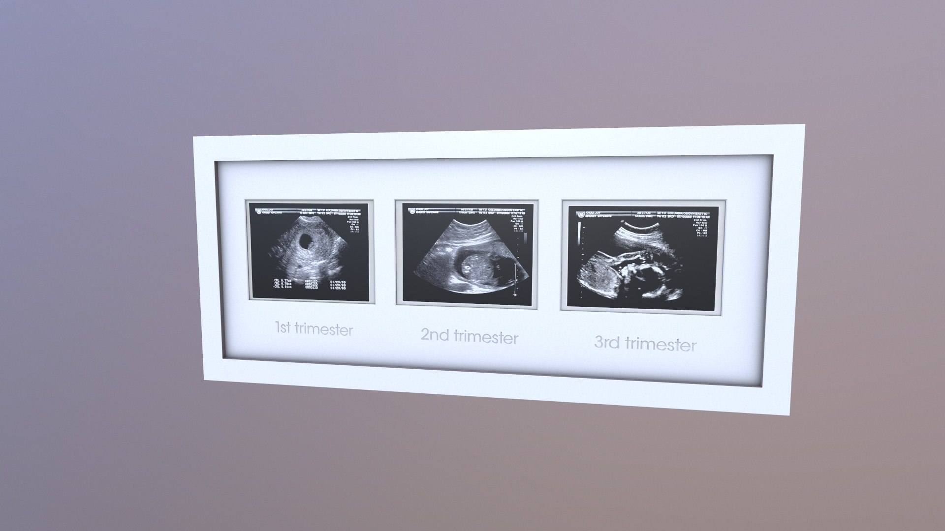 3D Pregnancy Frame Baby Scan Photo Frame - TurboSquid 2152083