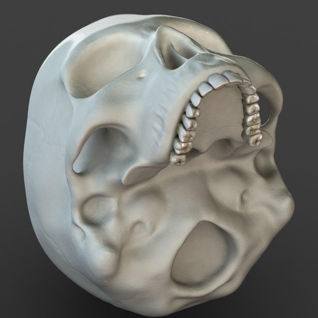 3d X-ray Male Face