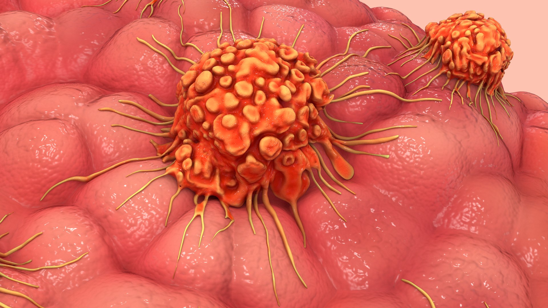 3D Cancer Cells Model - TurboSquid 2208157