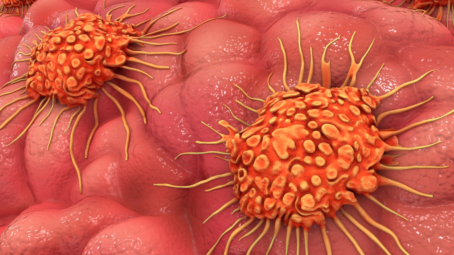 3D Cancer Cells Model - TurboSquid 2208157