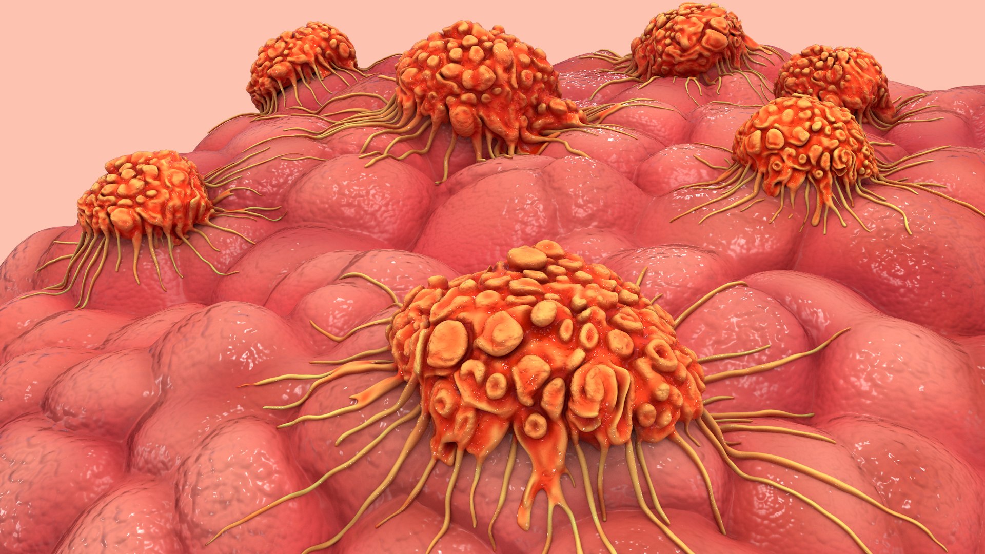 3D Cancer Cells Model - TurboSquid 2208157