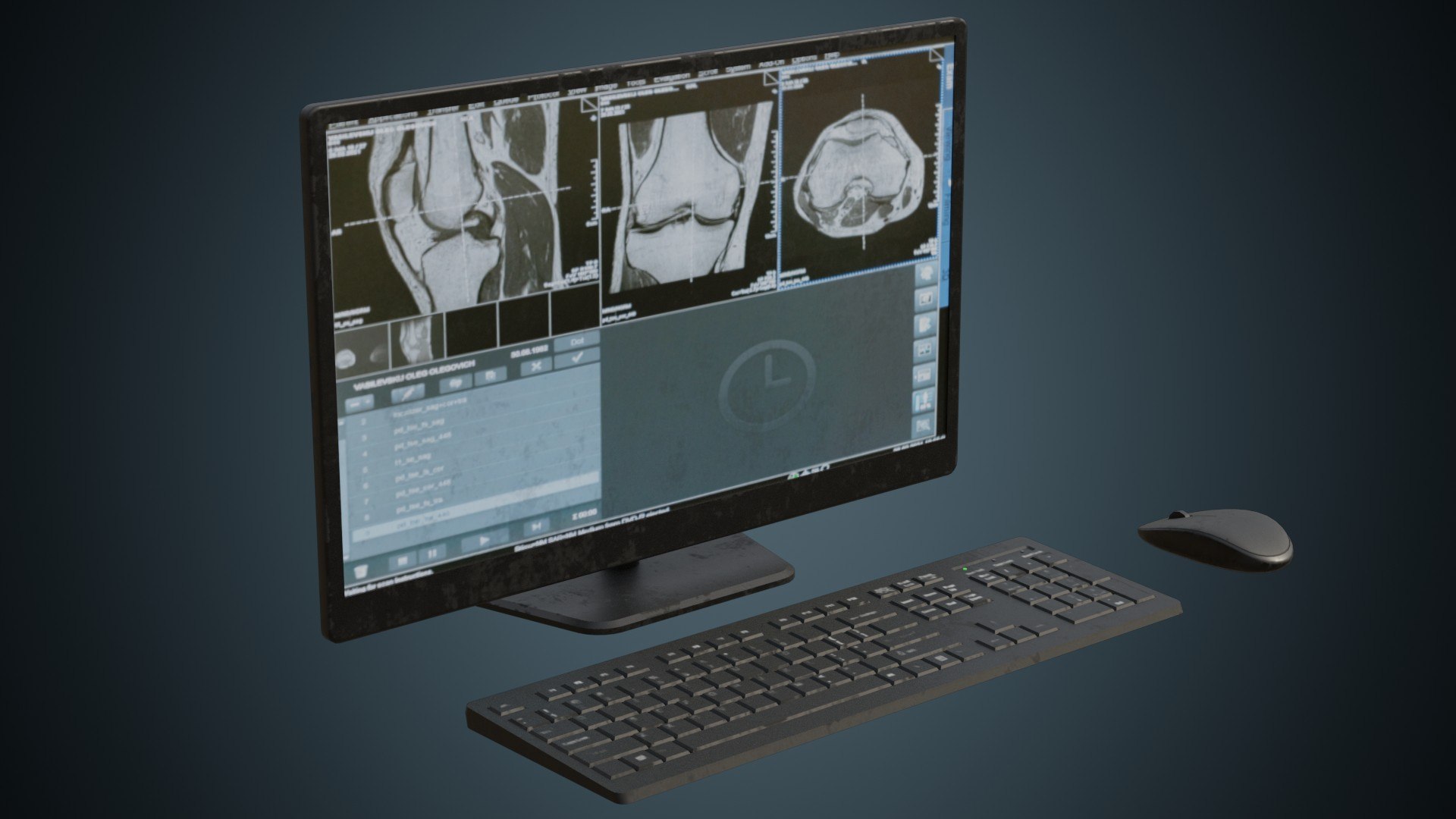 3D Medical Computer 2B Model - TurboSquid 2134500