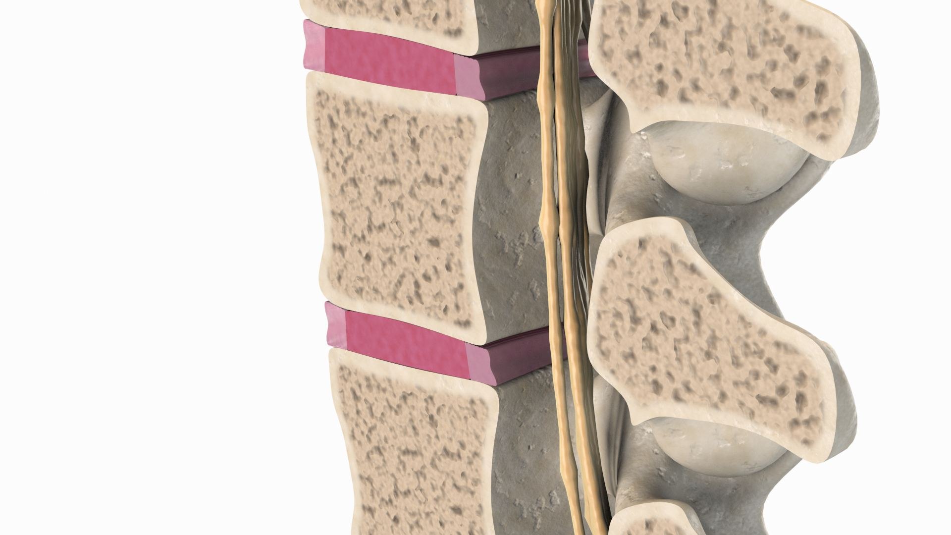 Slipped Bulging Herniated Herniation Disc Spine model - TurboSquid 1808903