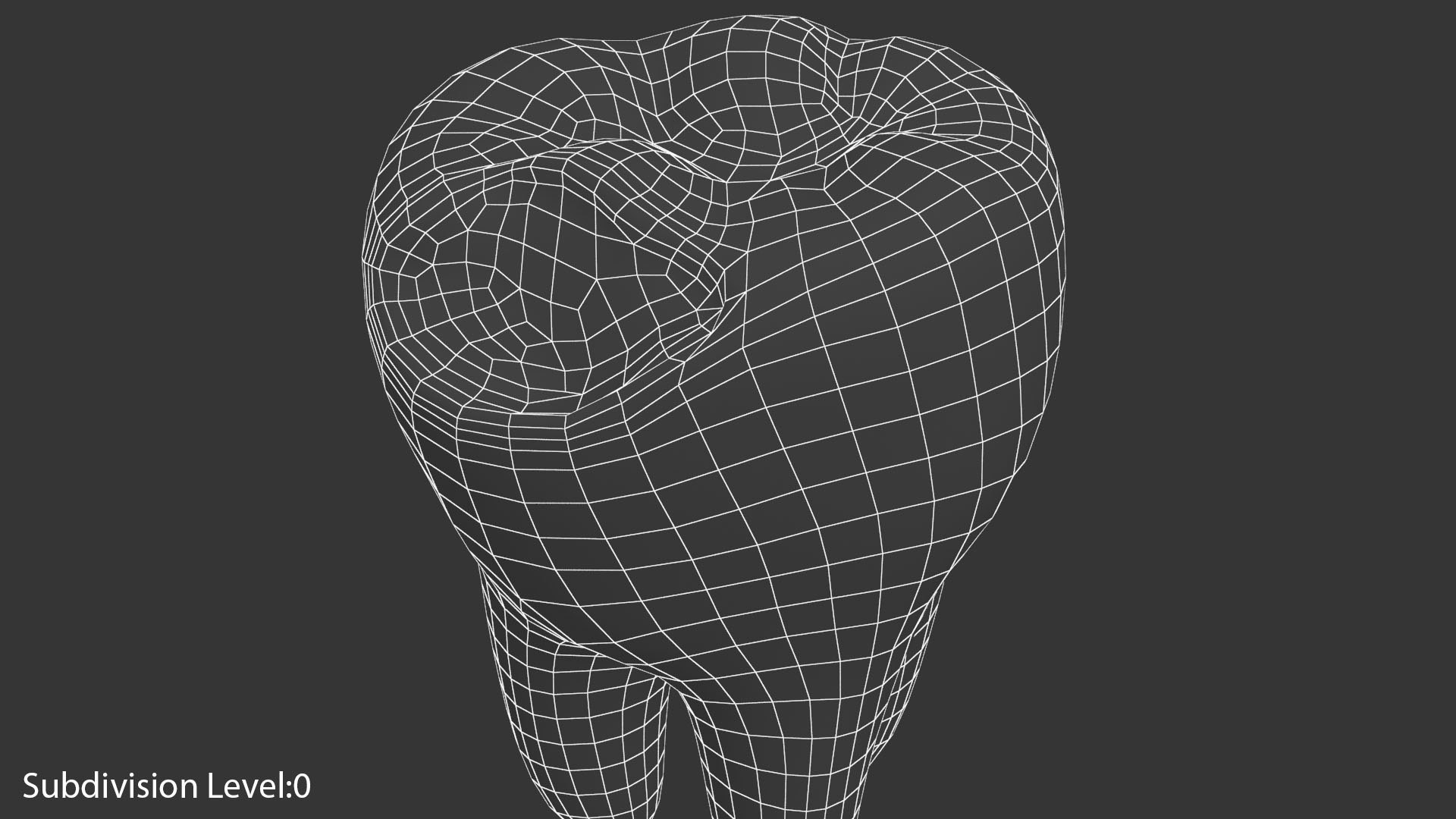 3D Teeth Decay - TurboSquid 1438019