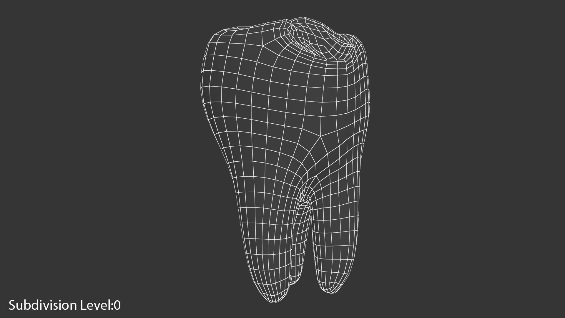 3D Teeth Decay - TurboSquid 1438019