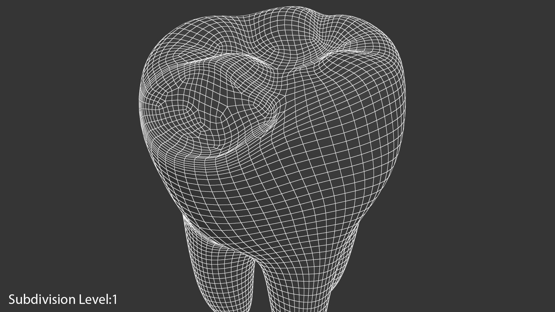 3D Teeth Decay - TurboSquid 1438019