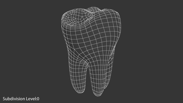 3D teeth decay - TurboSquid 1438019