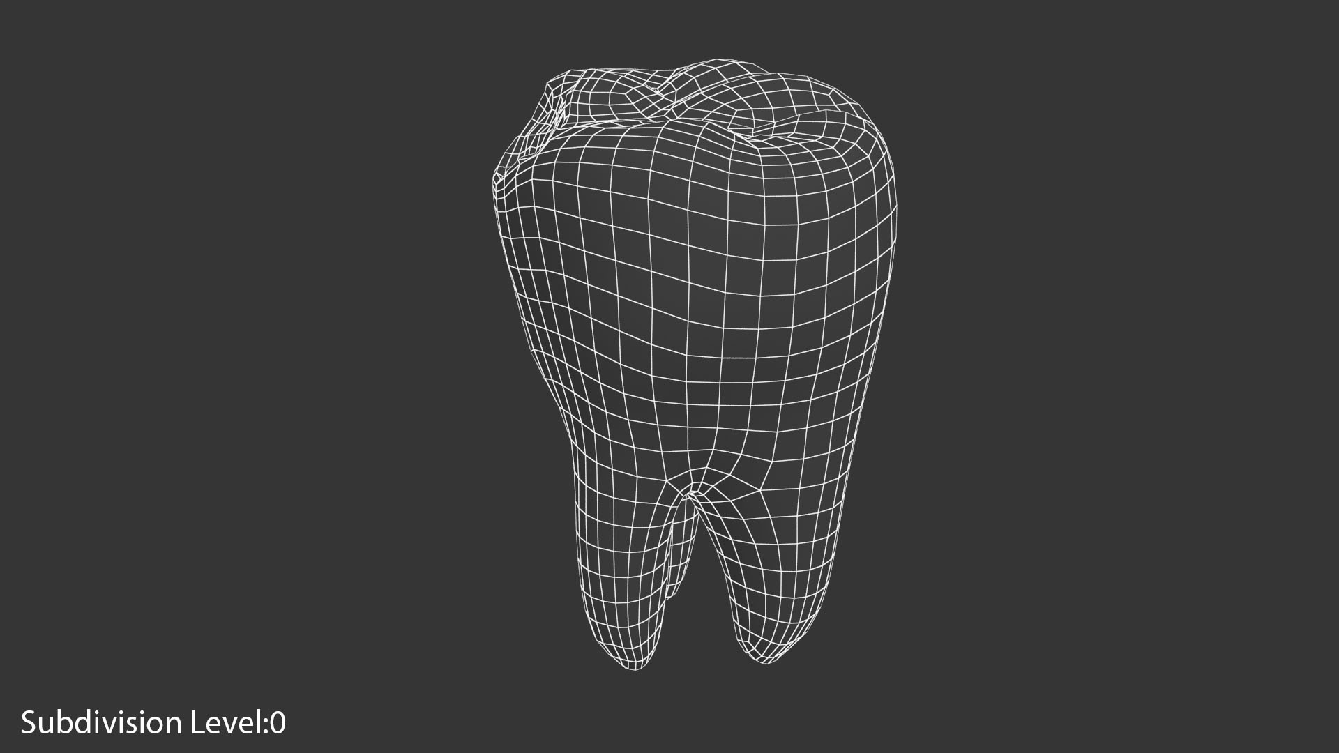 3D teeth decay - TurboSquid 1438019