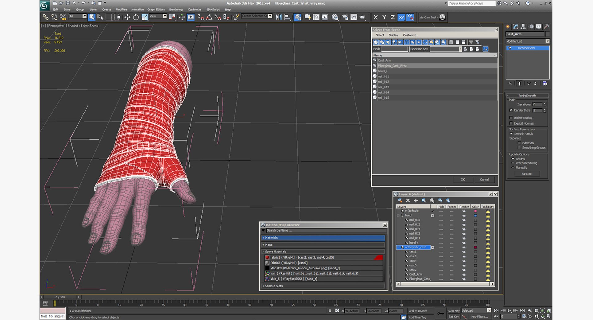 Fiberglass Cast Wrist Model - TurboSquid 1230113