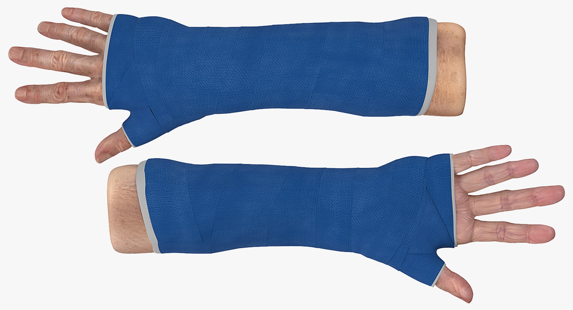 Fiberglass Cast Wrist Model - TurboSquid 1230113