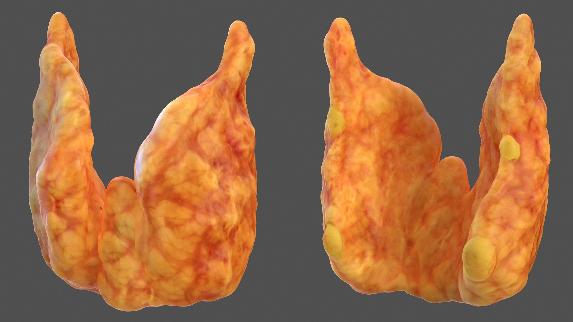 Human Thyroid 3D Model - TurboSquid 1459206