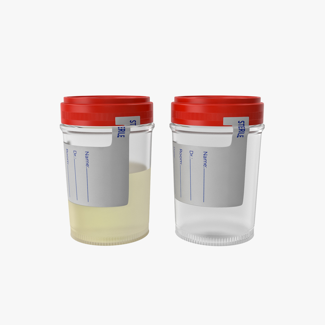 Urine Container Lid Sterile Max