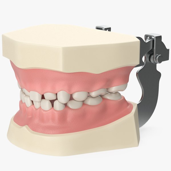 Dental Anatomy Model Simulation with Removable Crossbite Teeth3Dモデル ...