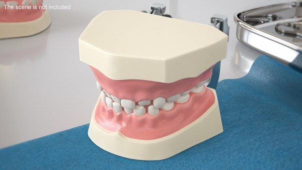 Dental Anatomy Model Simulation with Removable Crossbite Teeth3Dモデル ...