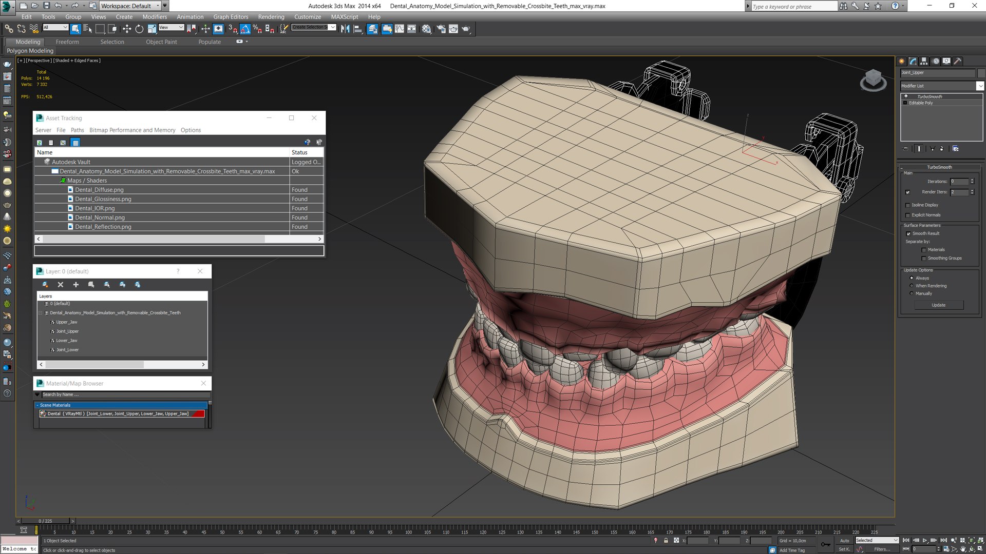 3D Dental Anatomy Model Simulation With Removable Crossbite Teeth - TurboSquid 2054516