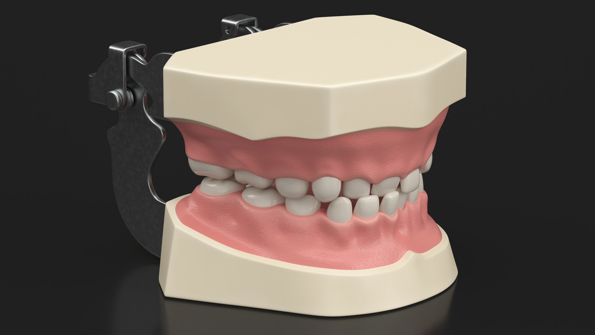 3D Dental Anatomy Model Simulation With Removable Crossbite Teeth ...