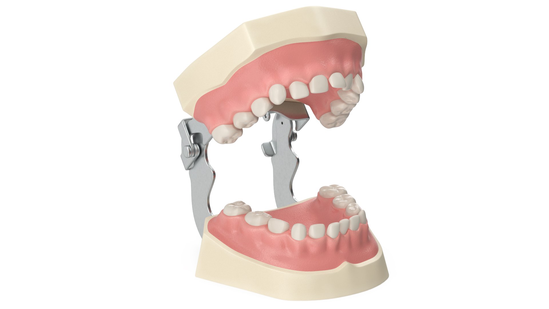 3D Dental Anatomy Model Simulation With Removable Crossbite Teeth ...
