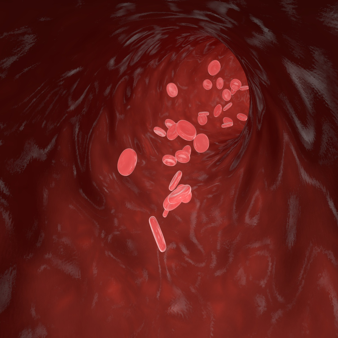 Turbulent Blood Flow C4d