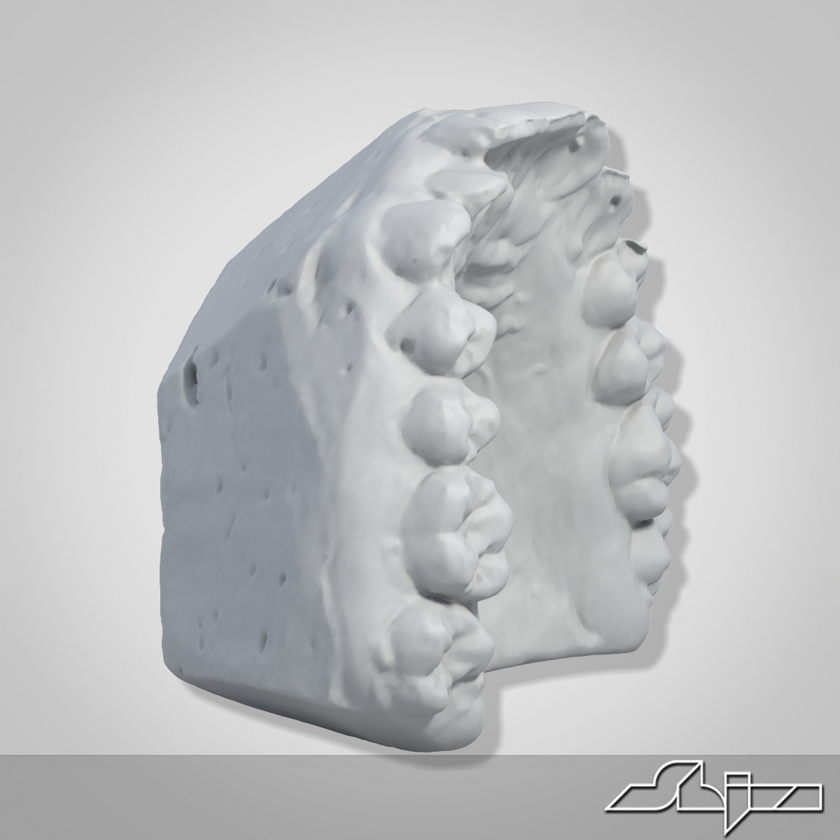 3d model gypsum mould teeth scan
