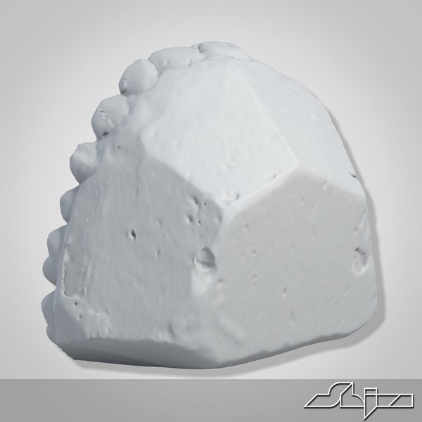3d model gypsum mould teeth scan