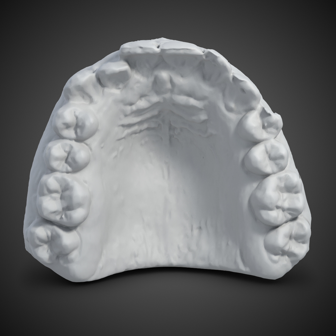 3d model gypsum mould teeth scan
