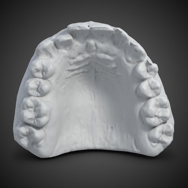 3d model gypsum mould teeth scan