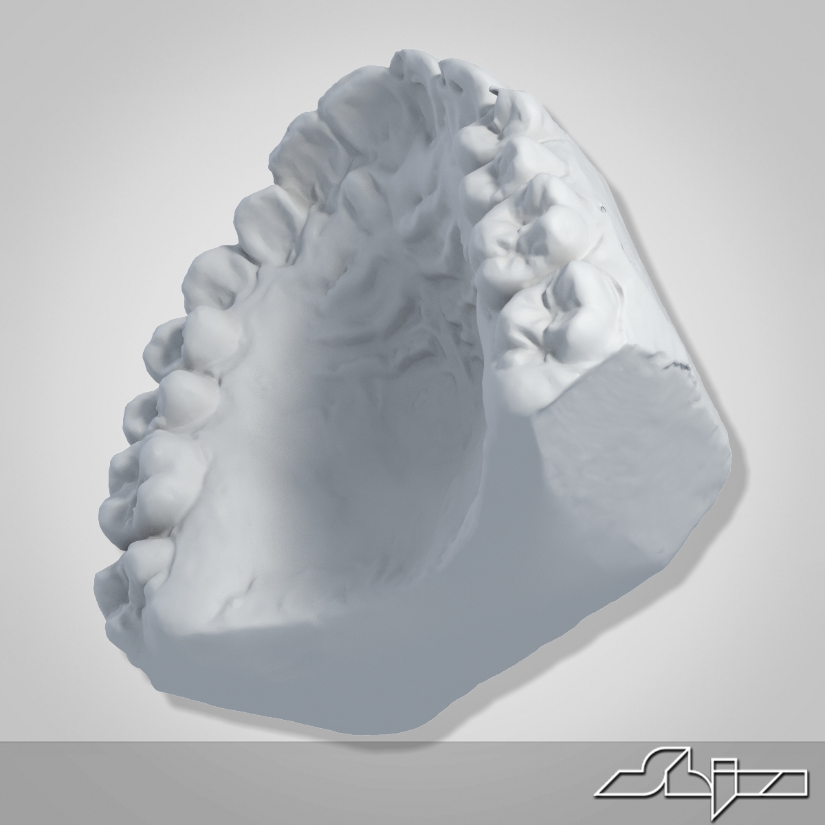 3d model gypsum mould teeth scan