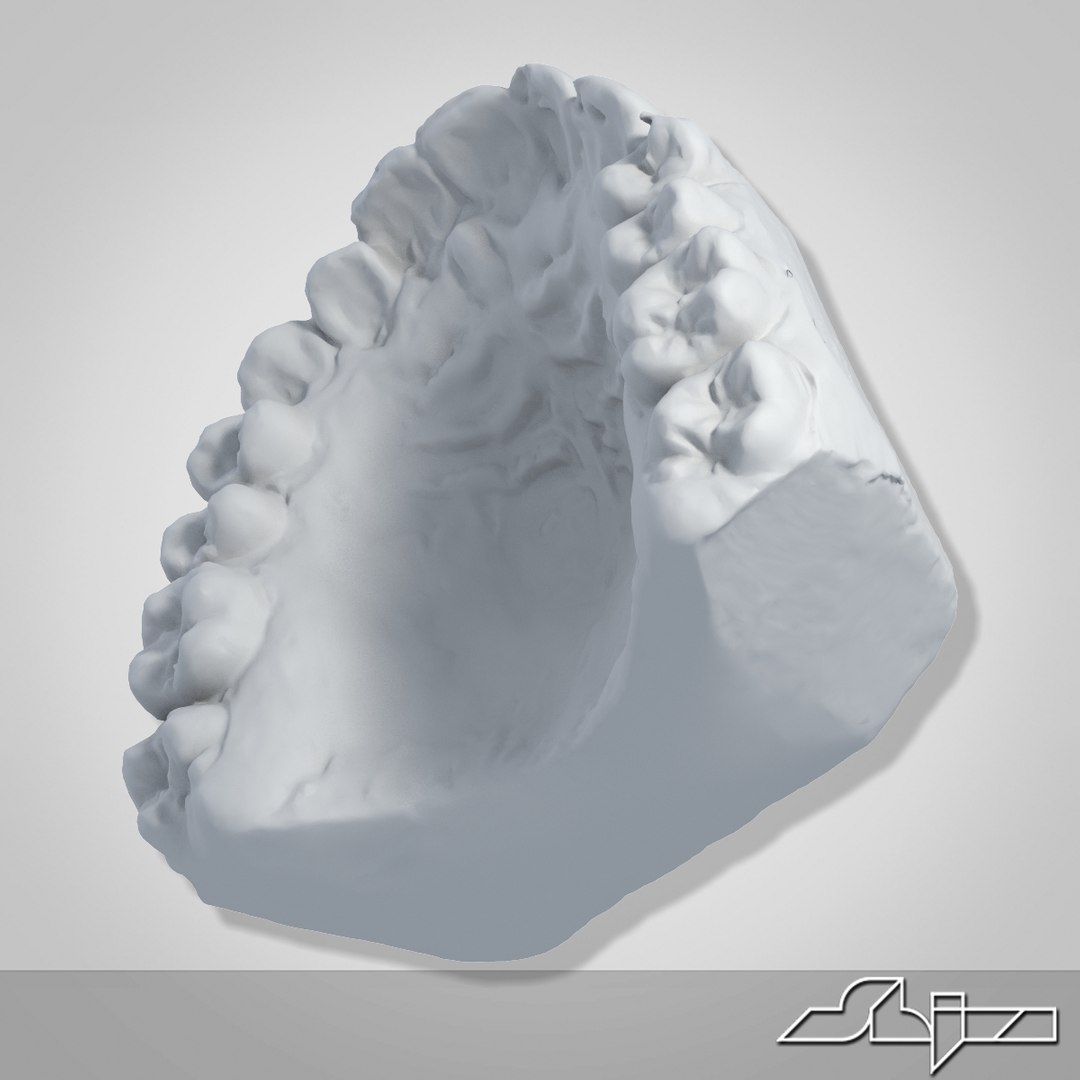 3d Model Gypsum Mould Teeth Scan