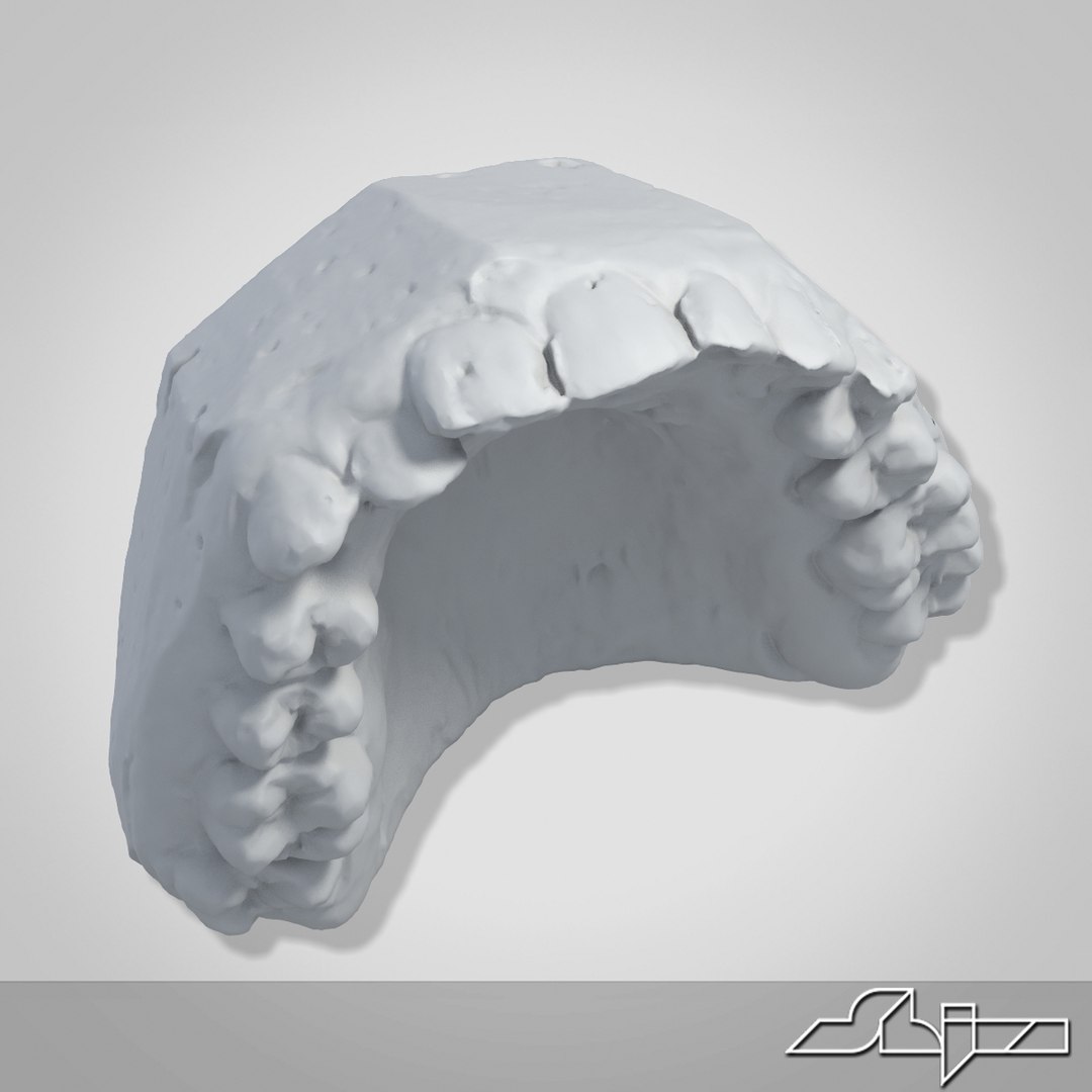 3d Model Gypsum Mould Teeth Scan