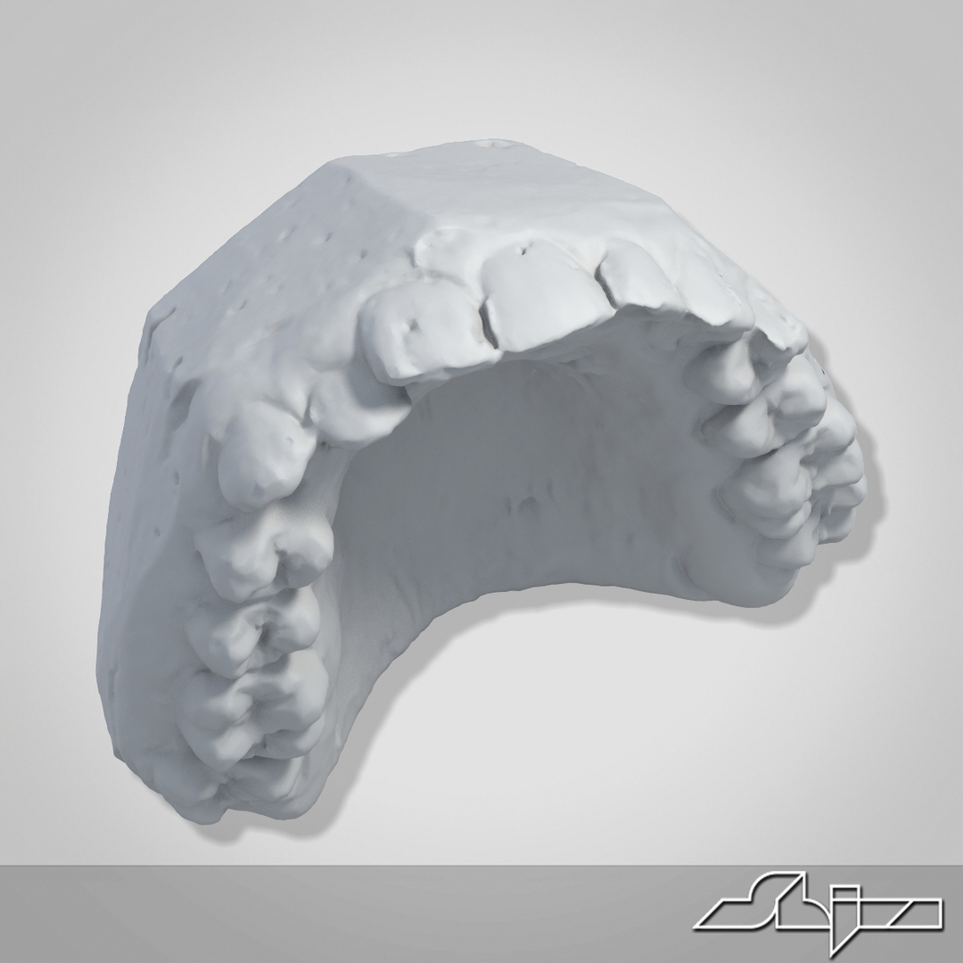 3d model gypsum mould teeth scan