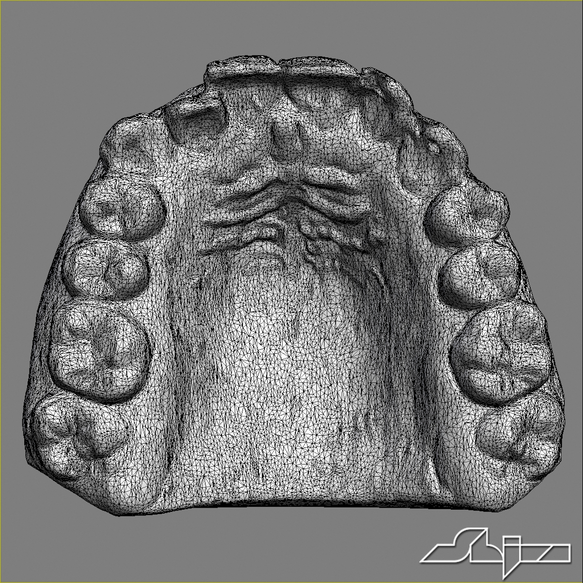 3d model gypsum mould teeth scan