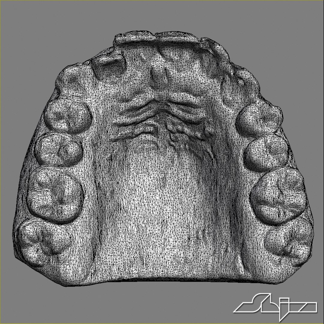 3d Model Gypsum Mould Teeth Scan