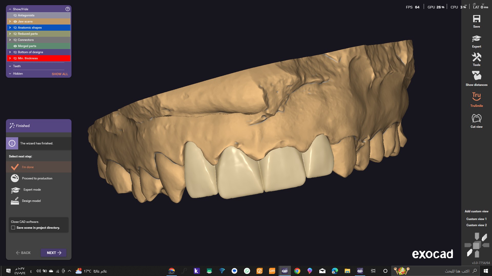 EXOCAD 3D - TurboSquid 2381457