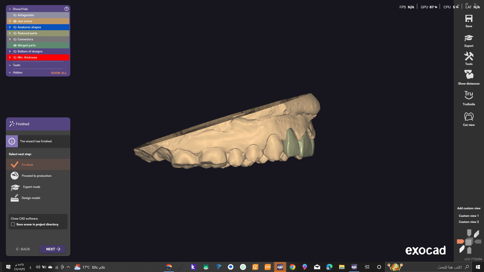 EXOCAD 3D - TurboSquid 2381457