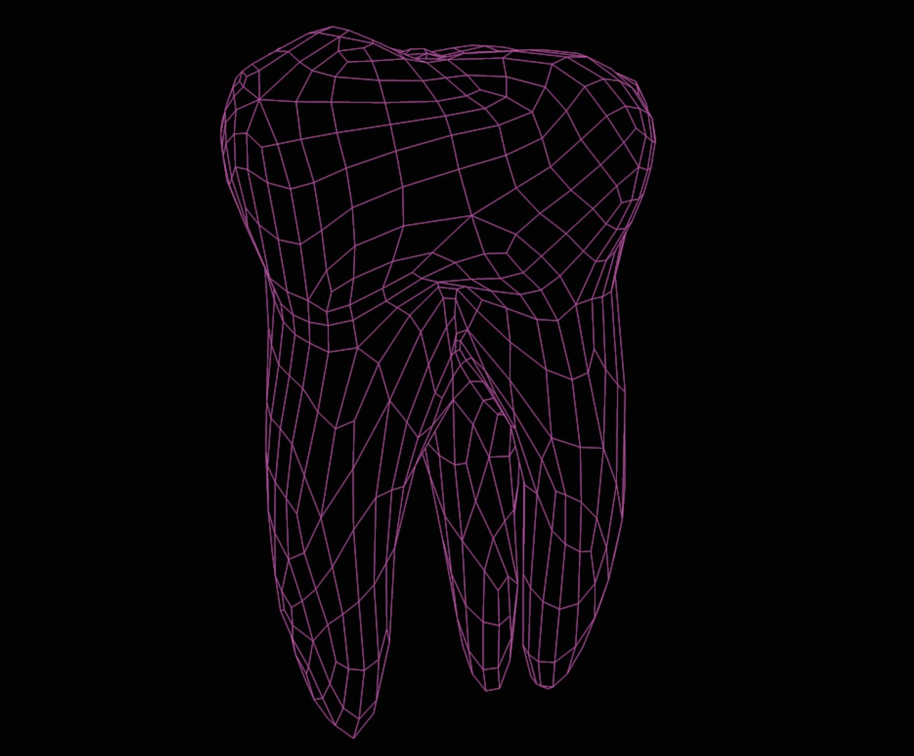 Molar Tooth 3d Model