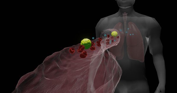 3D Infection Models | TurboSquid