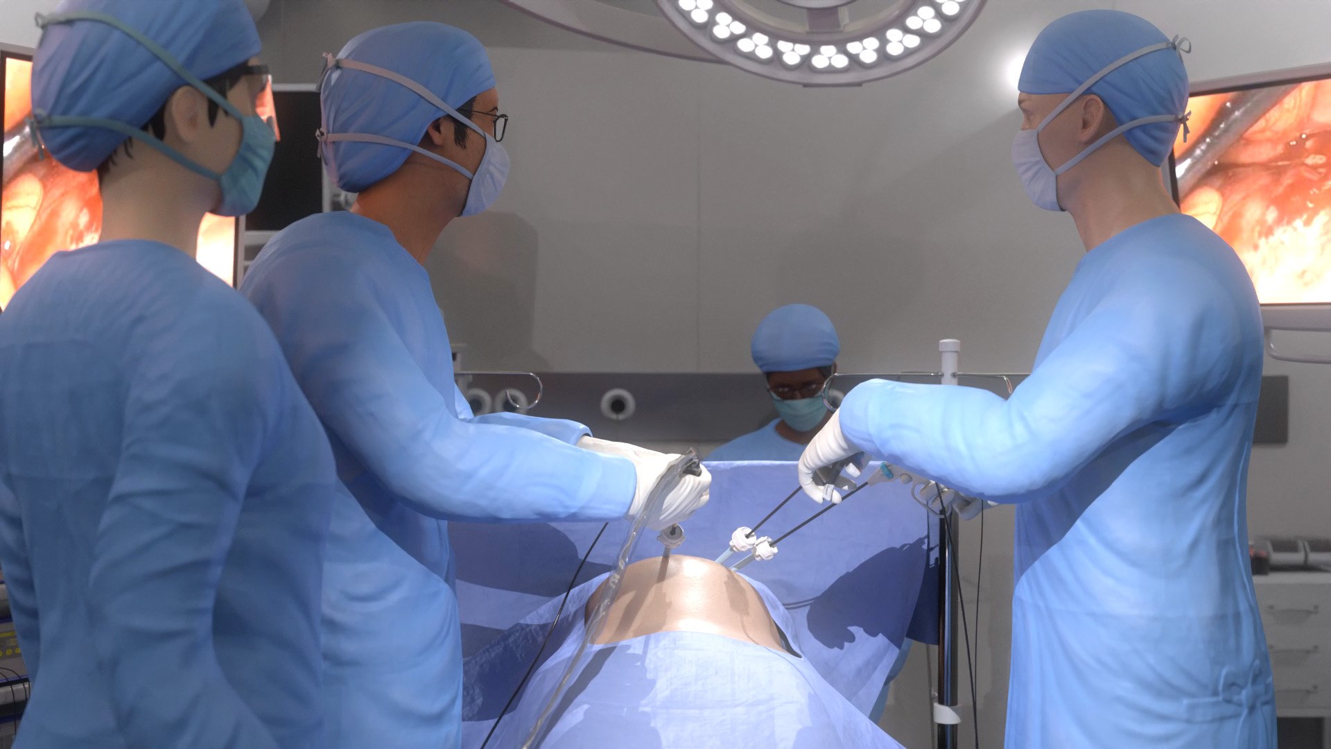 3D Laparoscopy Operation Scene - TurboSquid 2113559