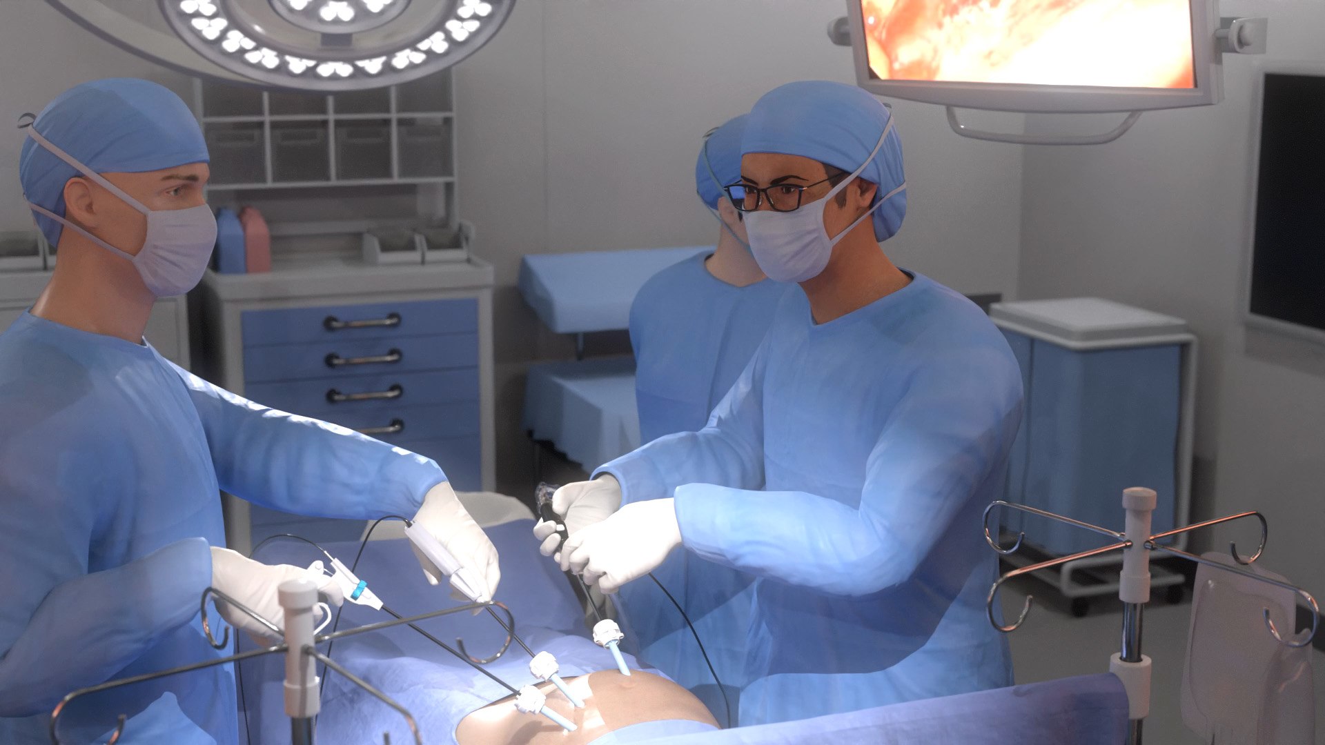 3D Laparoscopy Operation Scene - TurboSquid 2113559