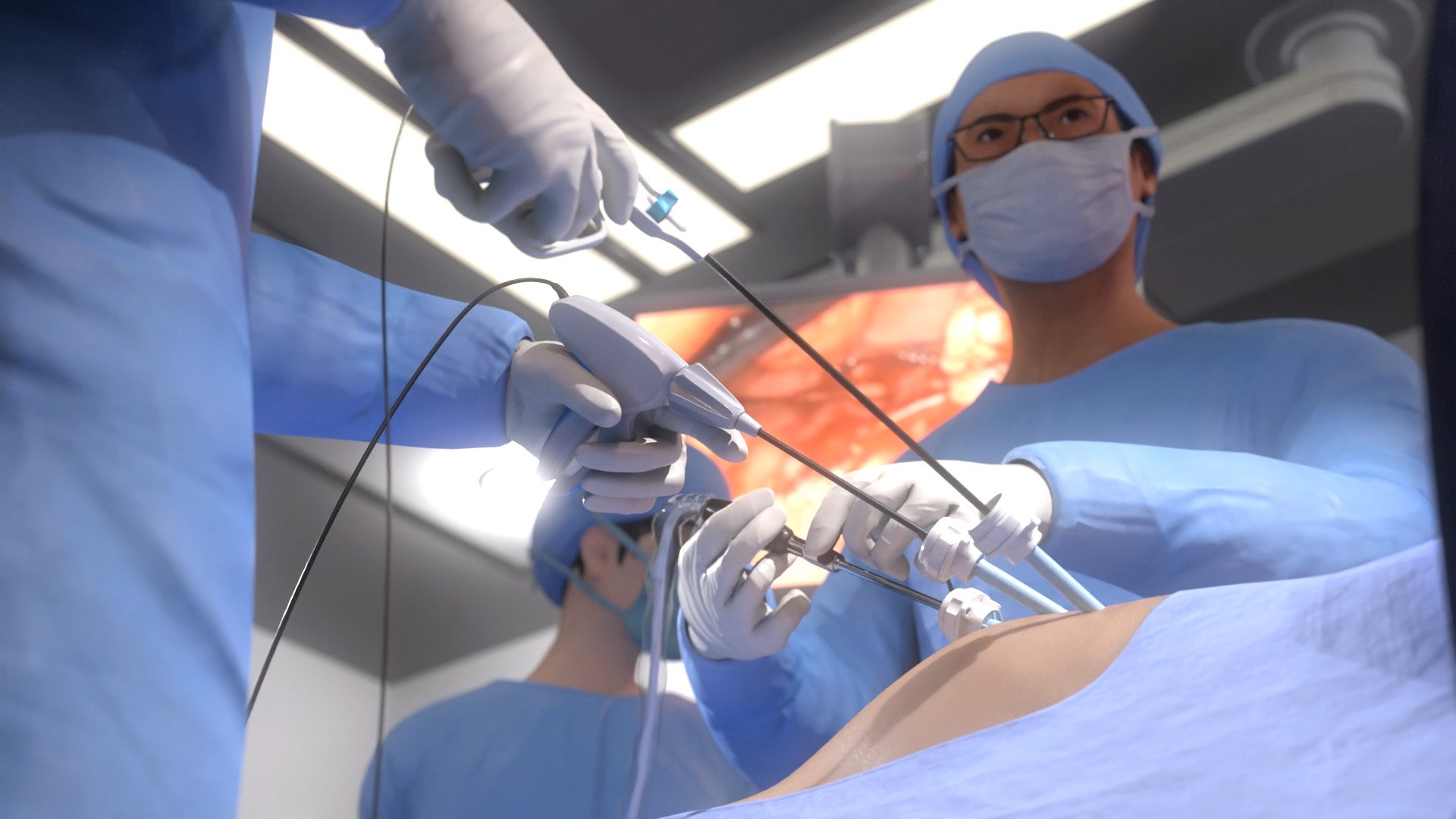 3D Laparoscopy Operation Scene - TurboSquid 2113559