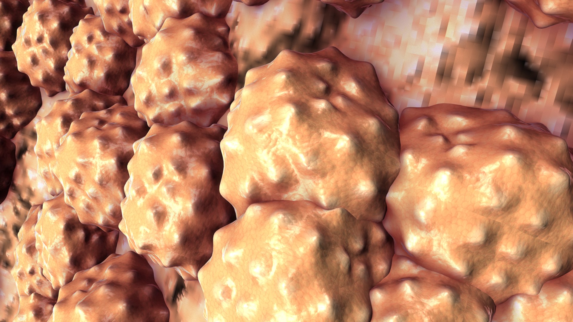 3d rheumatoid arthritis anatomy