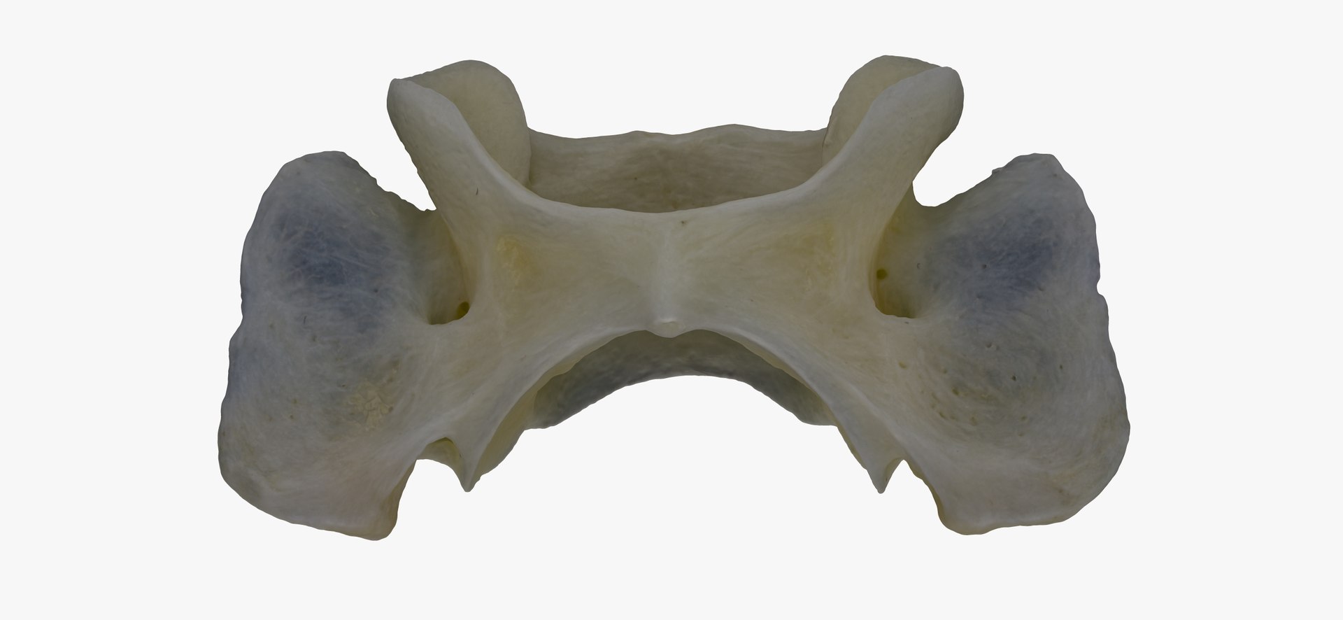 3D Domestic Cat Cervical Vertebrae C1 Atlas 01 RAW Scan - TurboSquid ...