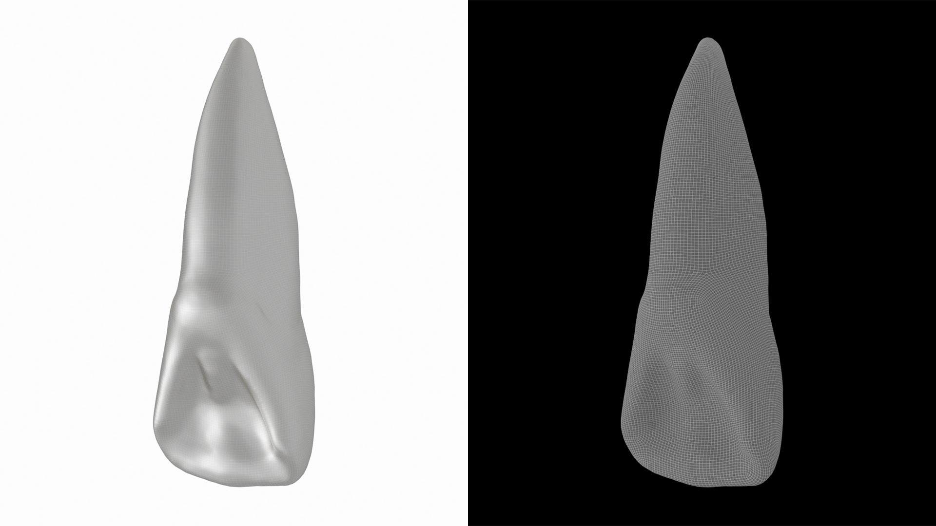 3D Human Upper Left Central Incisor Tooth - TurboSquid 2191920