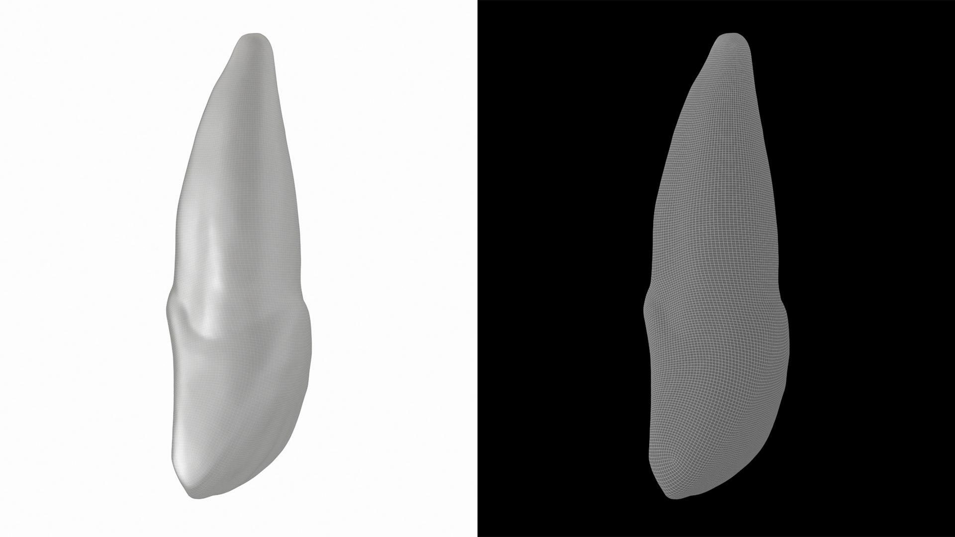 3D Human Upper Left Central Incisor Tooth - TurboSquid 2191920