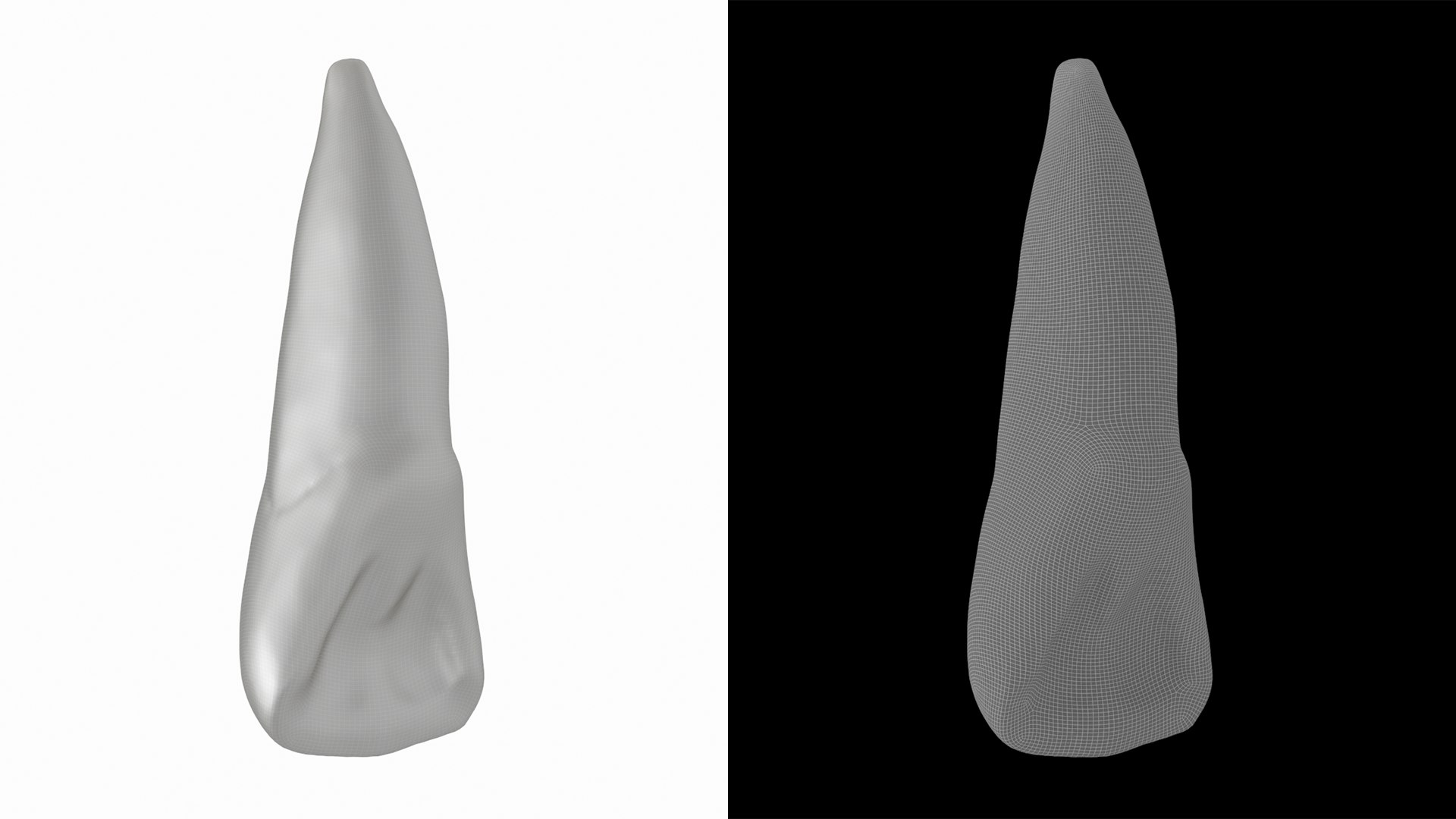 3D Human Upper Left Central Incisor Tooth - TurboSquid 2191920