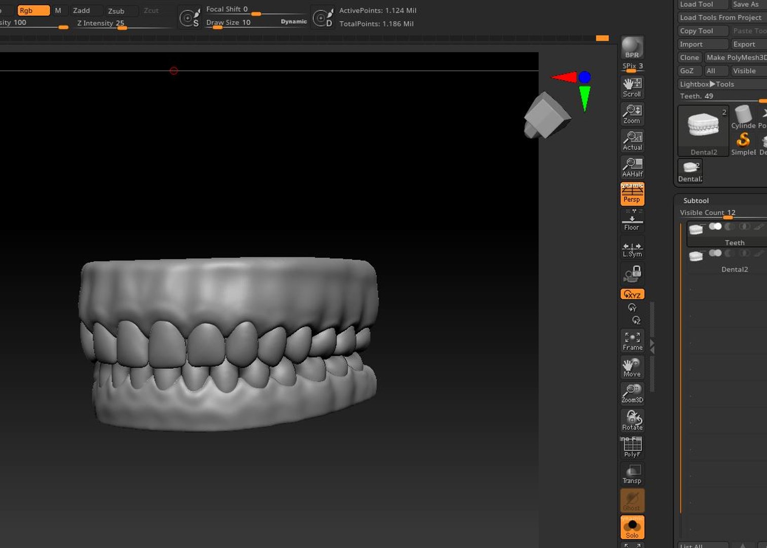Dental Prosthesis Modelling 3D Model - TurboSquid 1656597